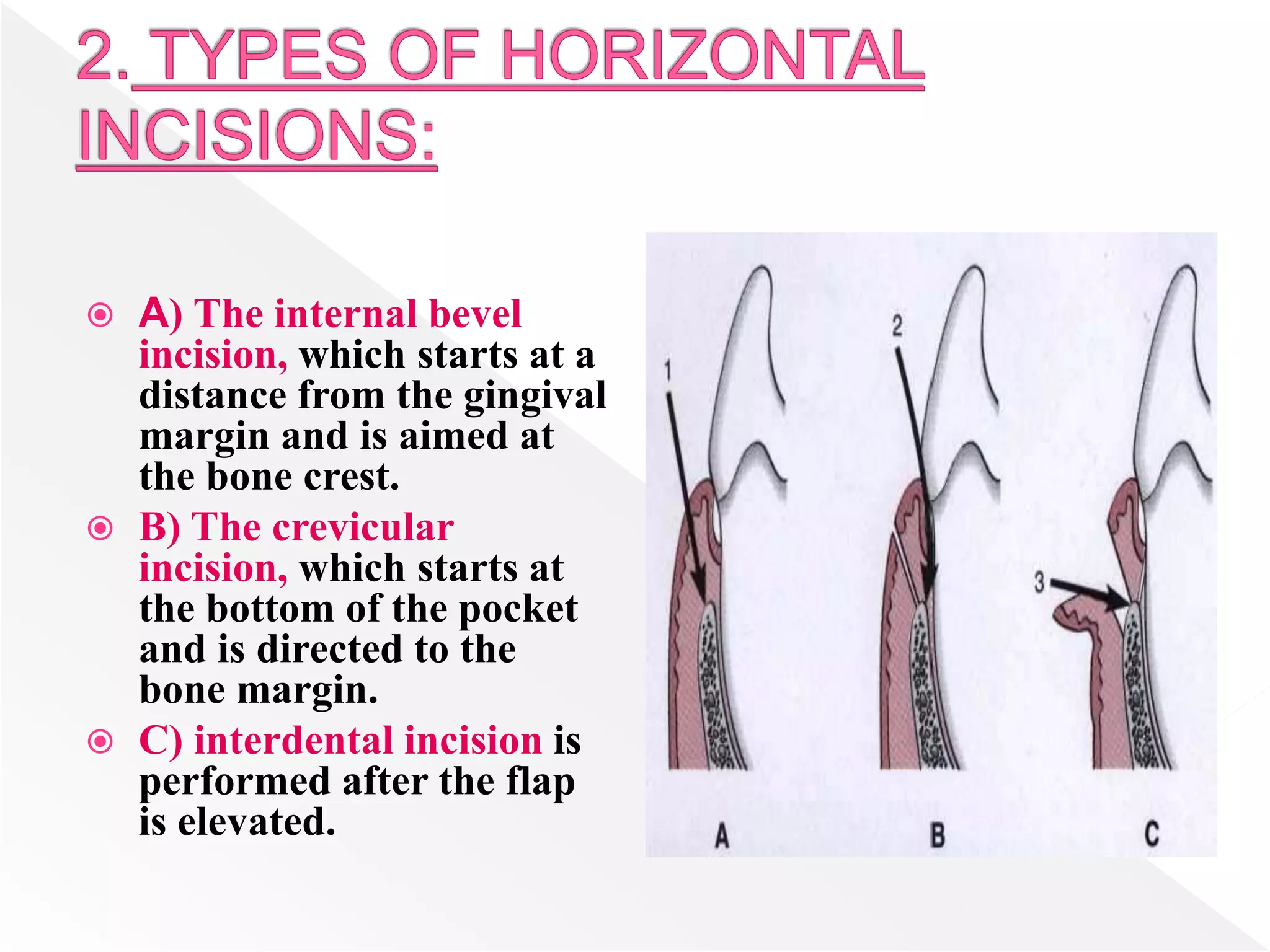 Principles of flap surgery copy | PPTX