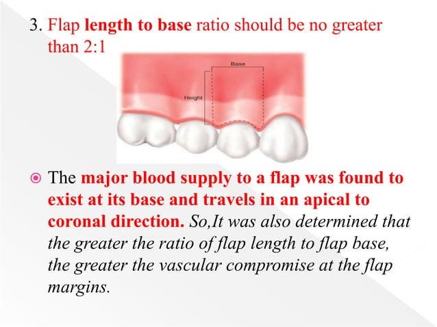 Principles of flap surgery copy | PPTX | Dental Health | Diseases and ...