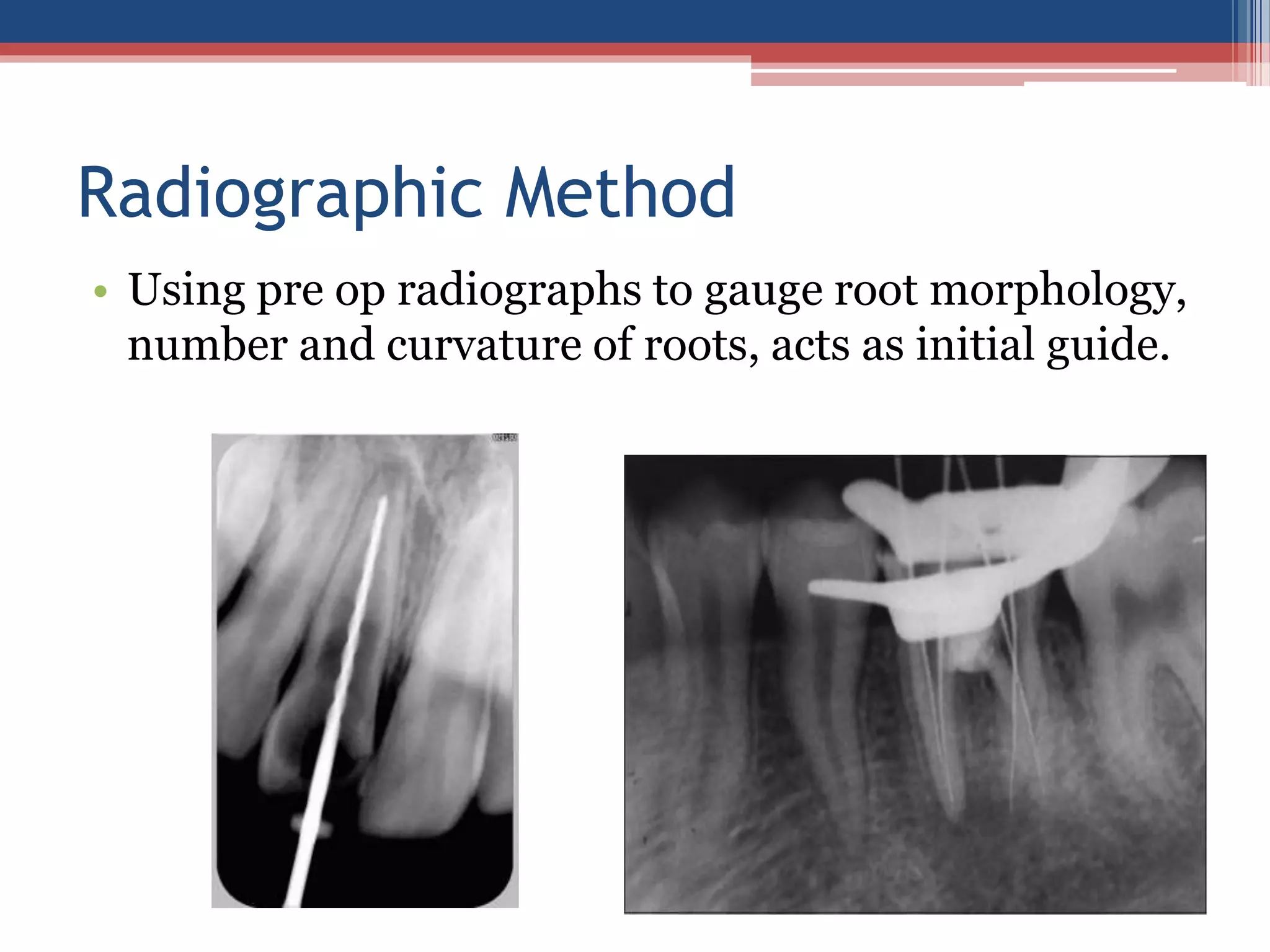 Wl determination & anatomy of the root apex | PPTX