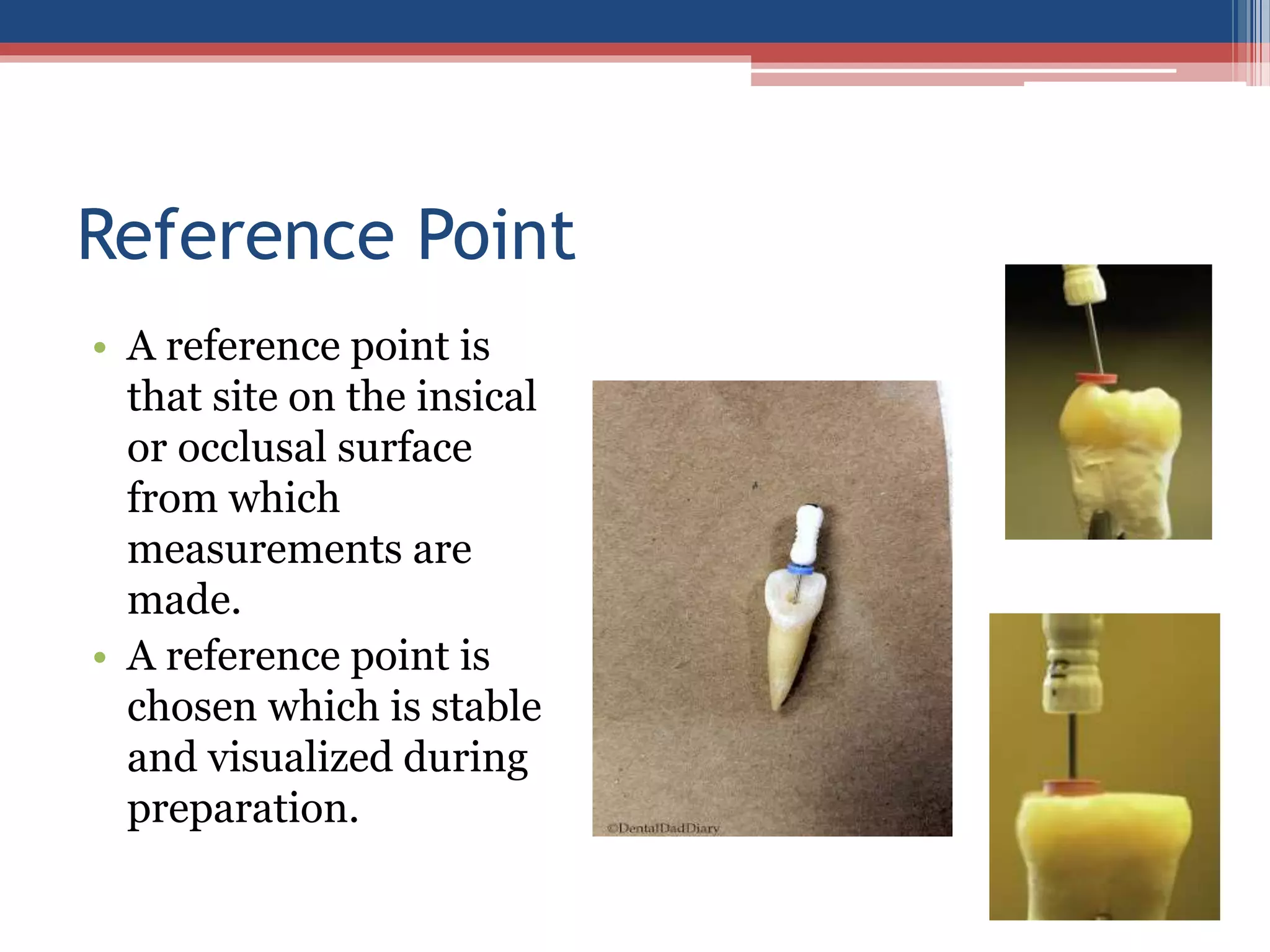 Wl determination & anatomy of the root apex | PPTX | Dental Health ...