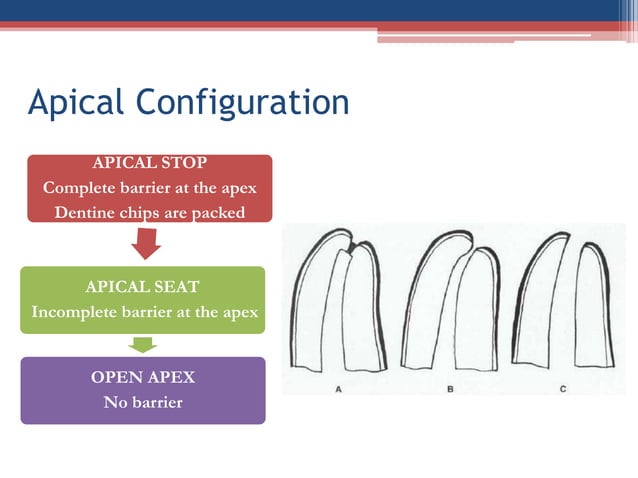 Wl determination & anatomy of the root apex | PPT