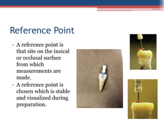 Wl determination & anatomy of the root apex | PPTX