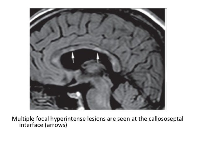 Diagnostic Imaging of Degenerative & White Matter Diseases