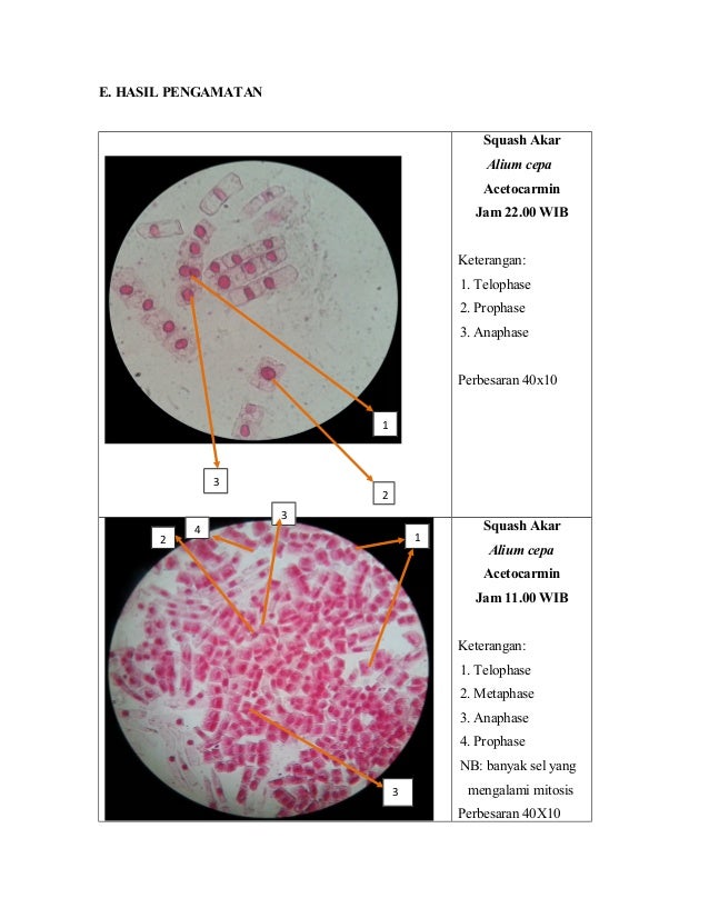 Preparat Whole Mount Protozoa_Preparat Rentang Mesenterium_Preparat S…
