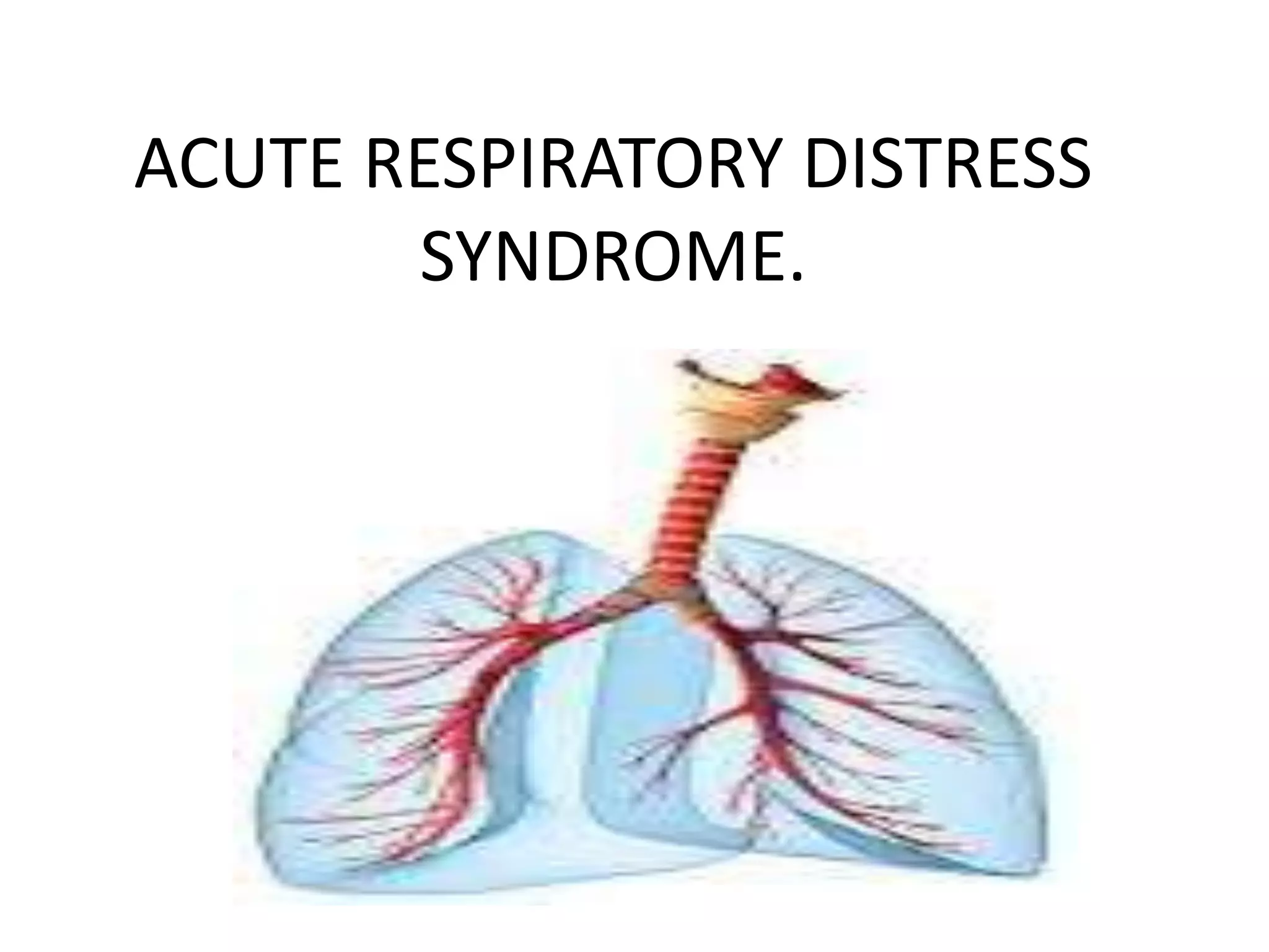 Acute respiratory distress syndrome | PPT