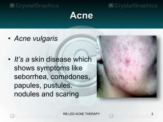 Red & Blue Led Treatment for Acne | PPTX