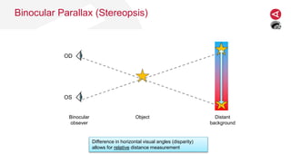 Evaluation of Stereopsis for Blended Vision Variants with Refractive ...