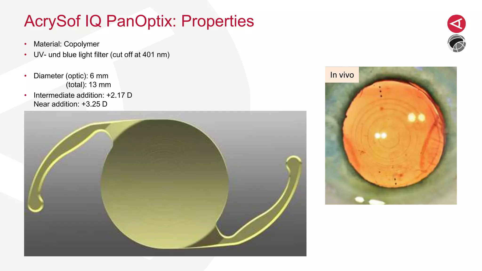 Introduction of a new diffractive trifocal intraocular lens. Comparison ...