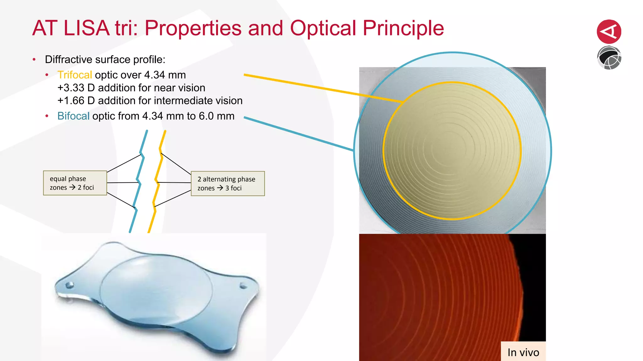 Introduction of a new diffractive trifocal intraocular lens. Comparison ...