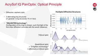 Introduction of a new diffractive trifocal intraocular lens. Comparison ...