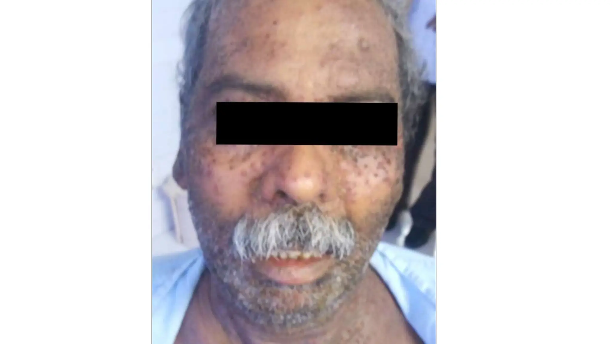 skin dermatoses overview only presentation.pptx