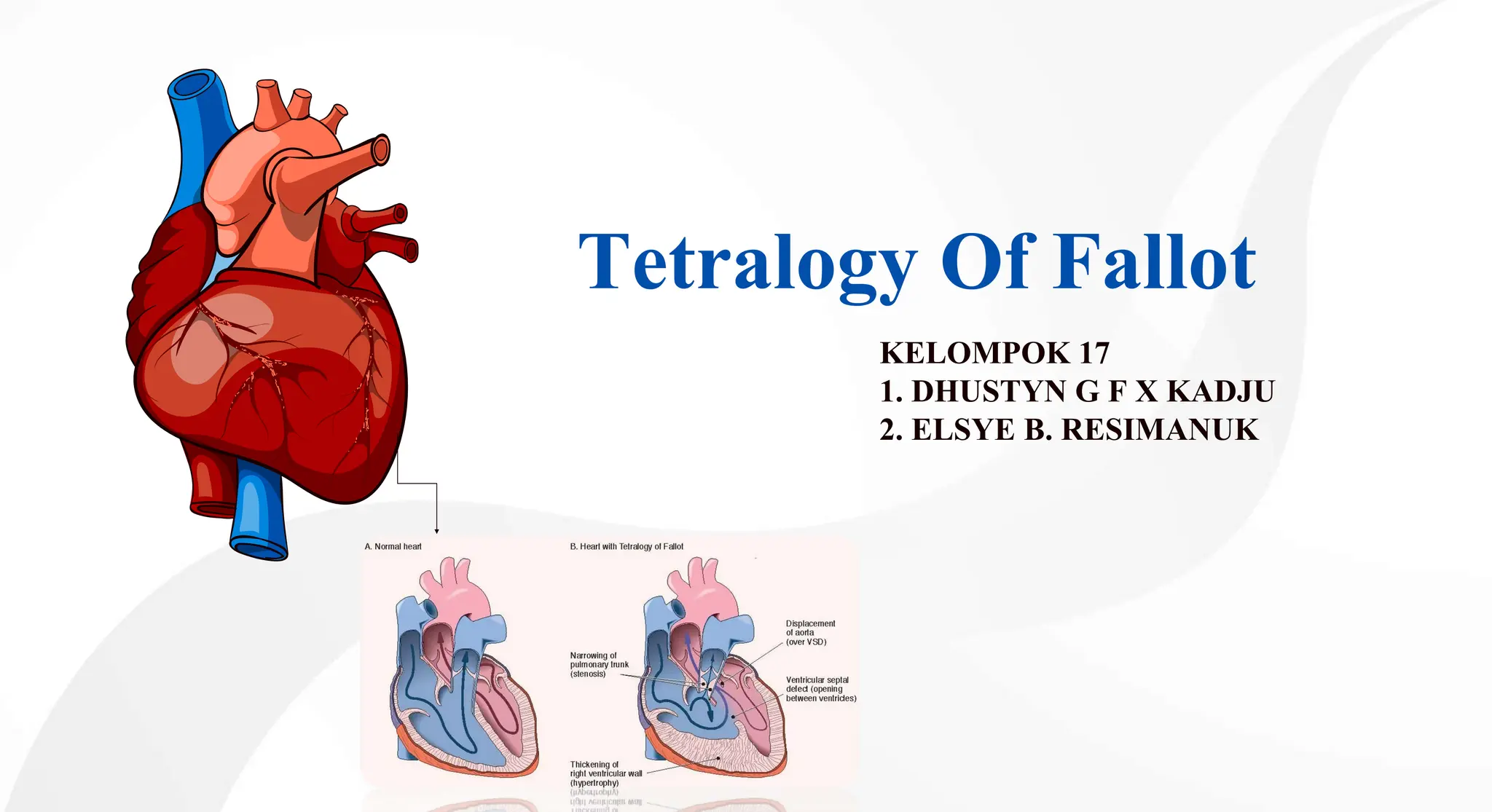 WOC Tetralogi Of Fallot (TOF) dan skenario kasus_UKIM AMBON .pdf