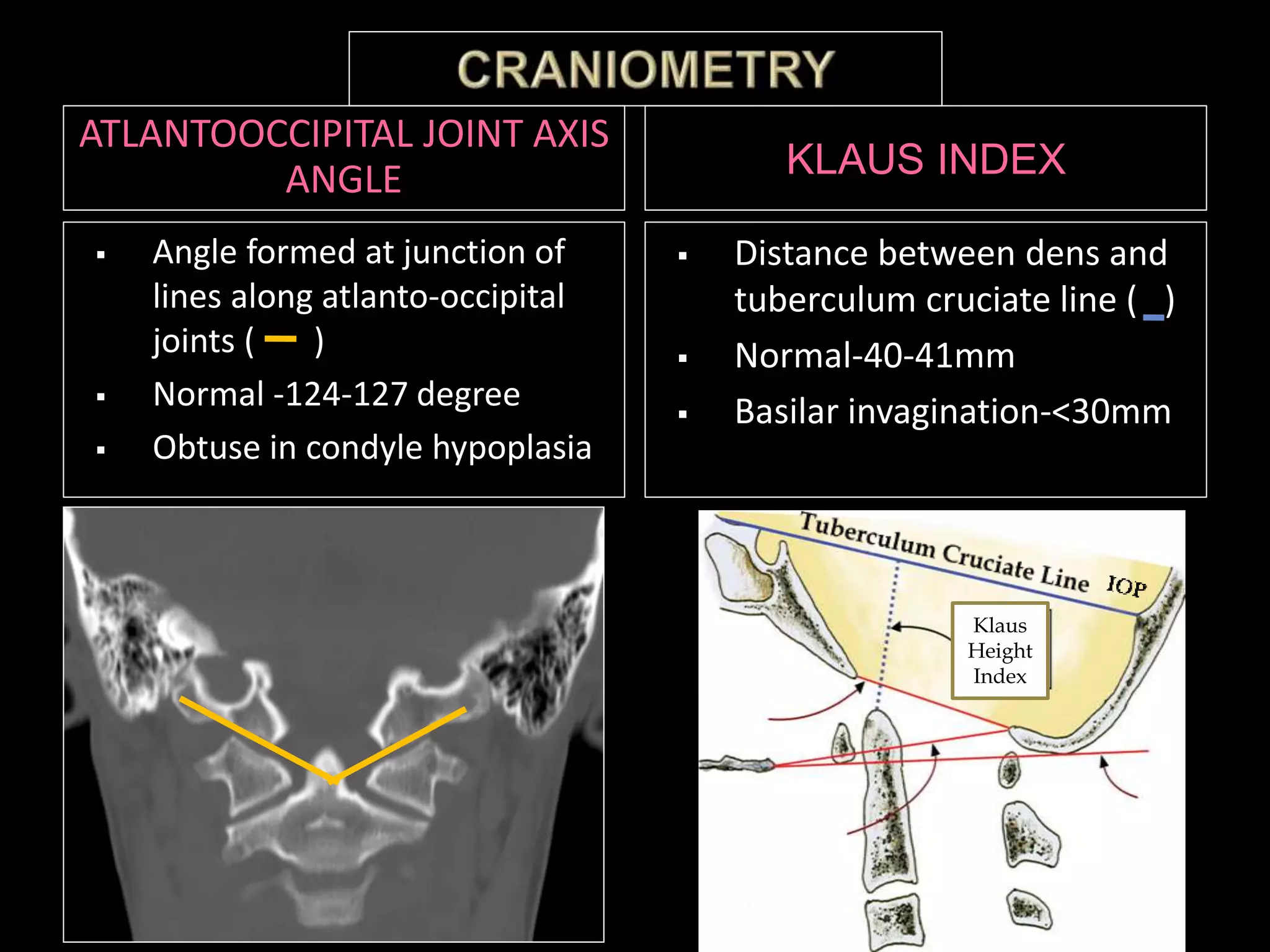 Craniovertebral anomalies | PPTX