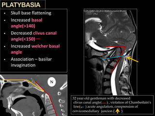 Craniovertebral anomalies | PPTX