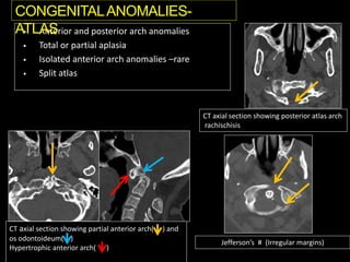 Craniovertebral anomalies | PPTX