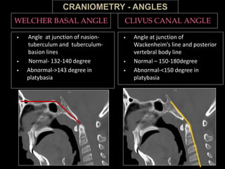 Platybasia Xray