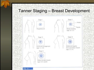 Delayed Puberty Topics in Adolescent Gynecology Delayed Puberty Topics in Adolescent Gynecology ...