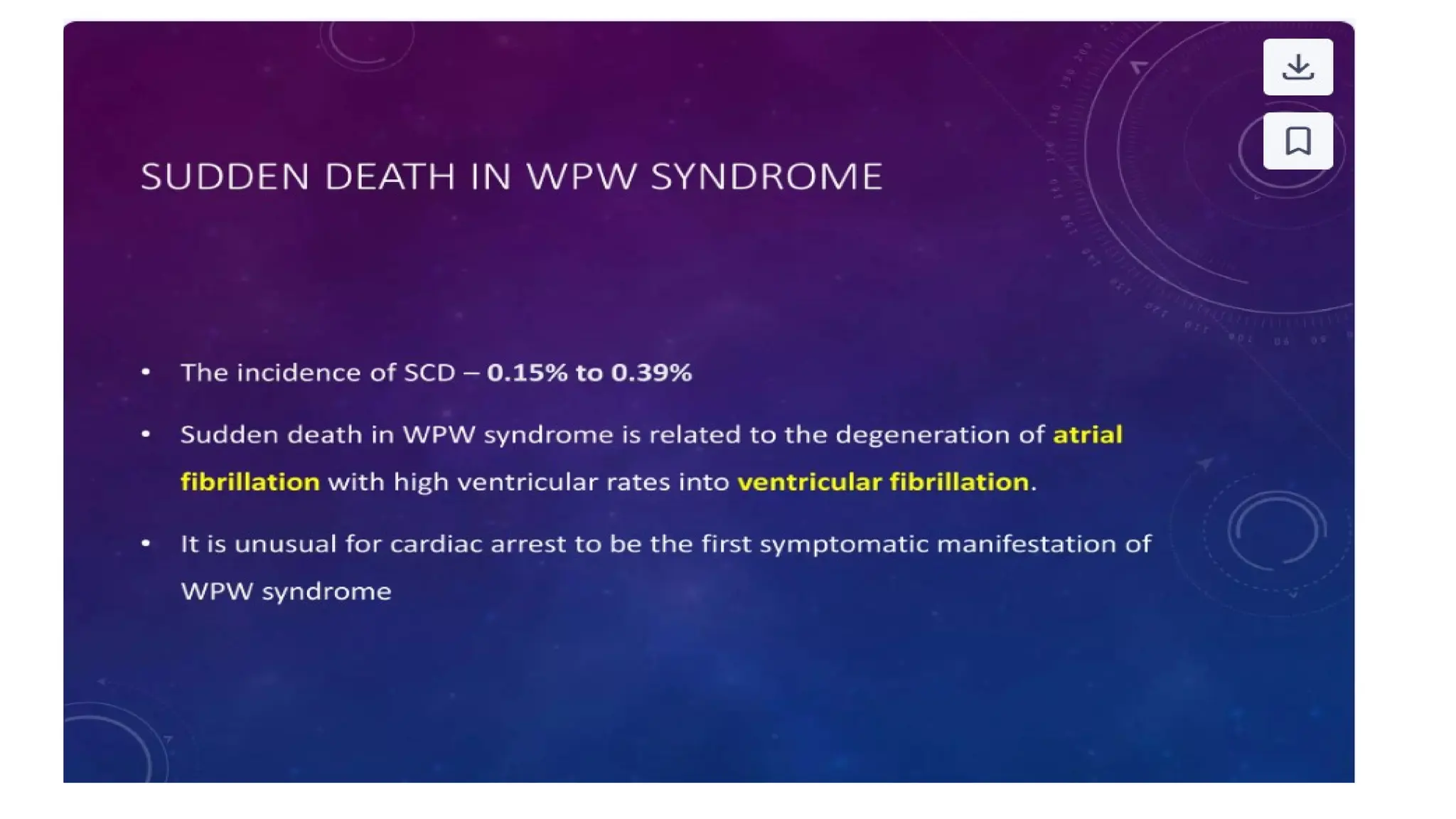lecture on Wolff-Parkinson-White (WPW) Syndrome | PPTX