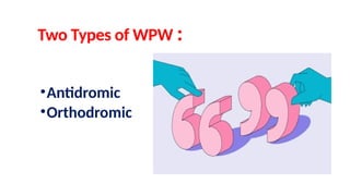 lecture on Wolff-Parkinson-White (WPW) Syndrome | PPTX