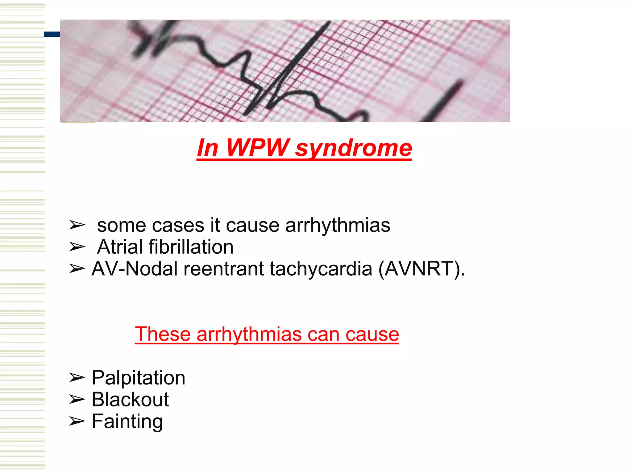 Wolff parkinson white syndrome | PPTX