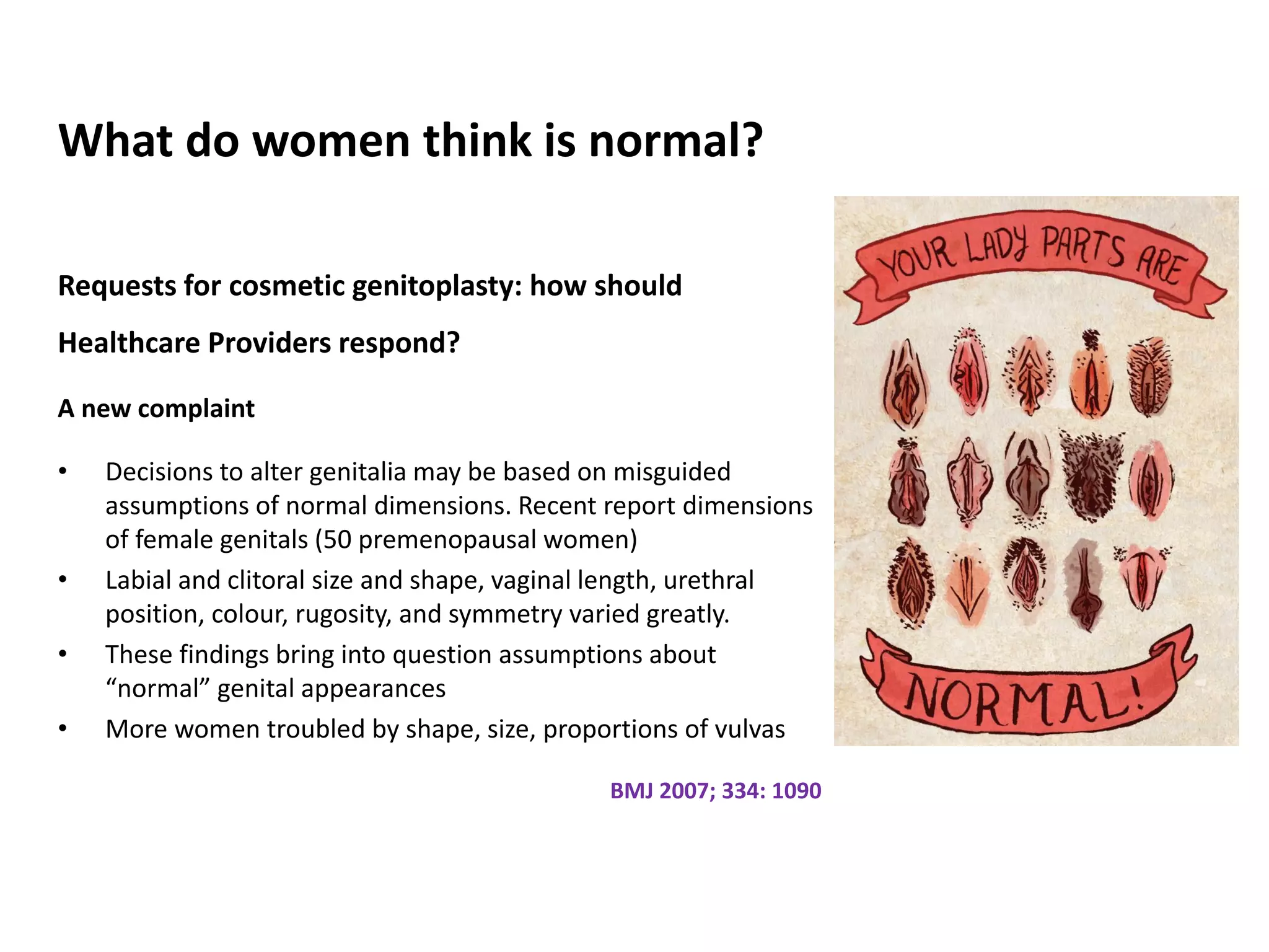 Female Genital Cosmetic Surgery (FGCS) ‘enhancement’ or ‘mutilation’? | PDF