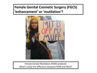 Female Genital Cosmetic Surgery (FGCS) ‘enhancement’ or ‘mutilation’? | PDF