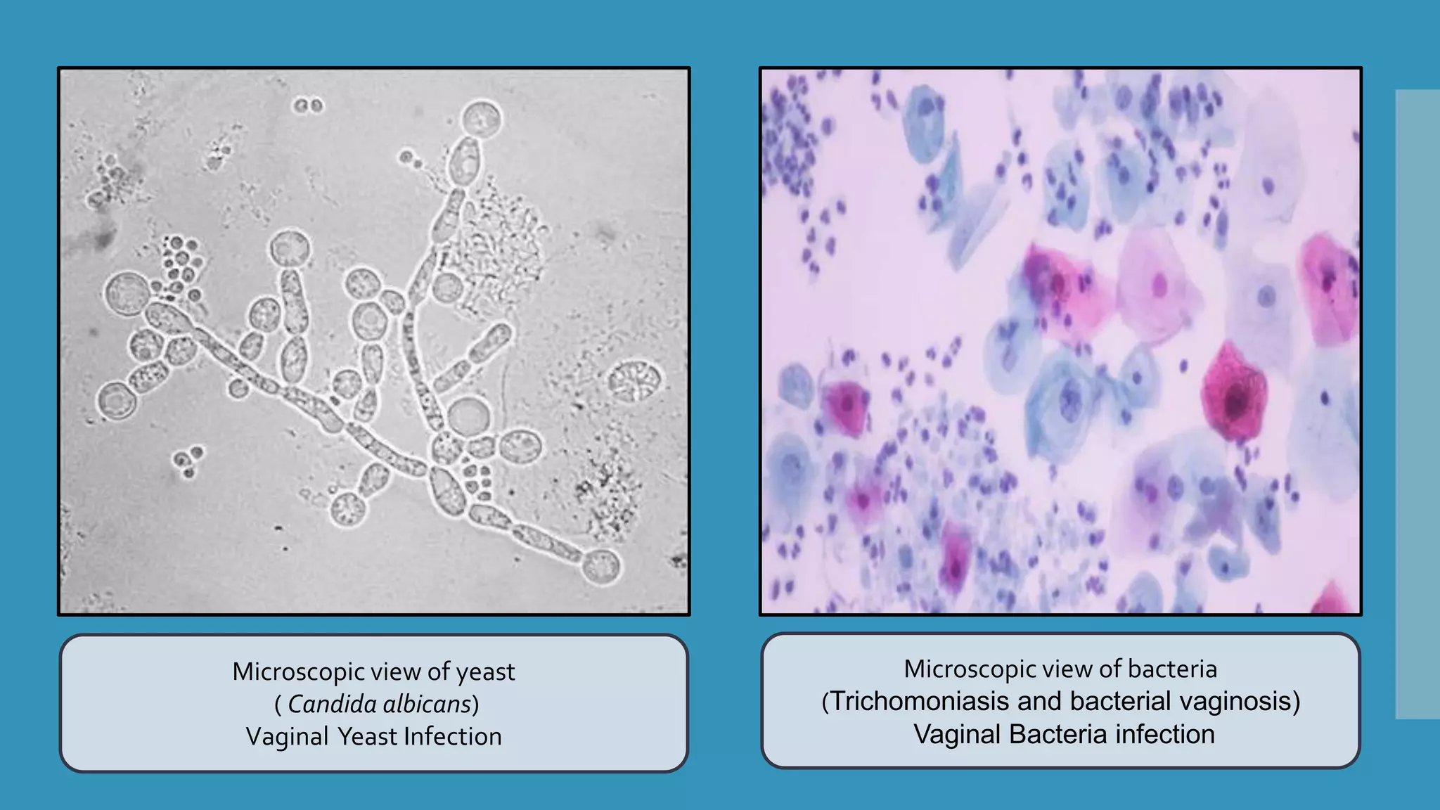 Women Health.pptx