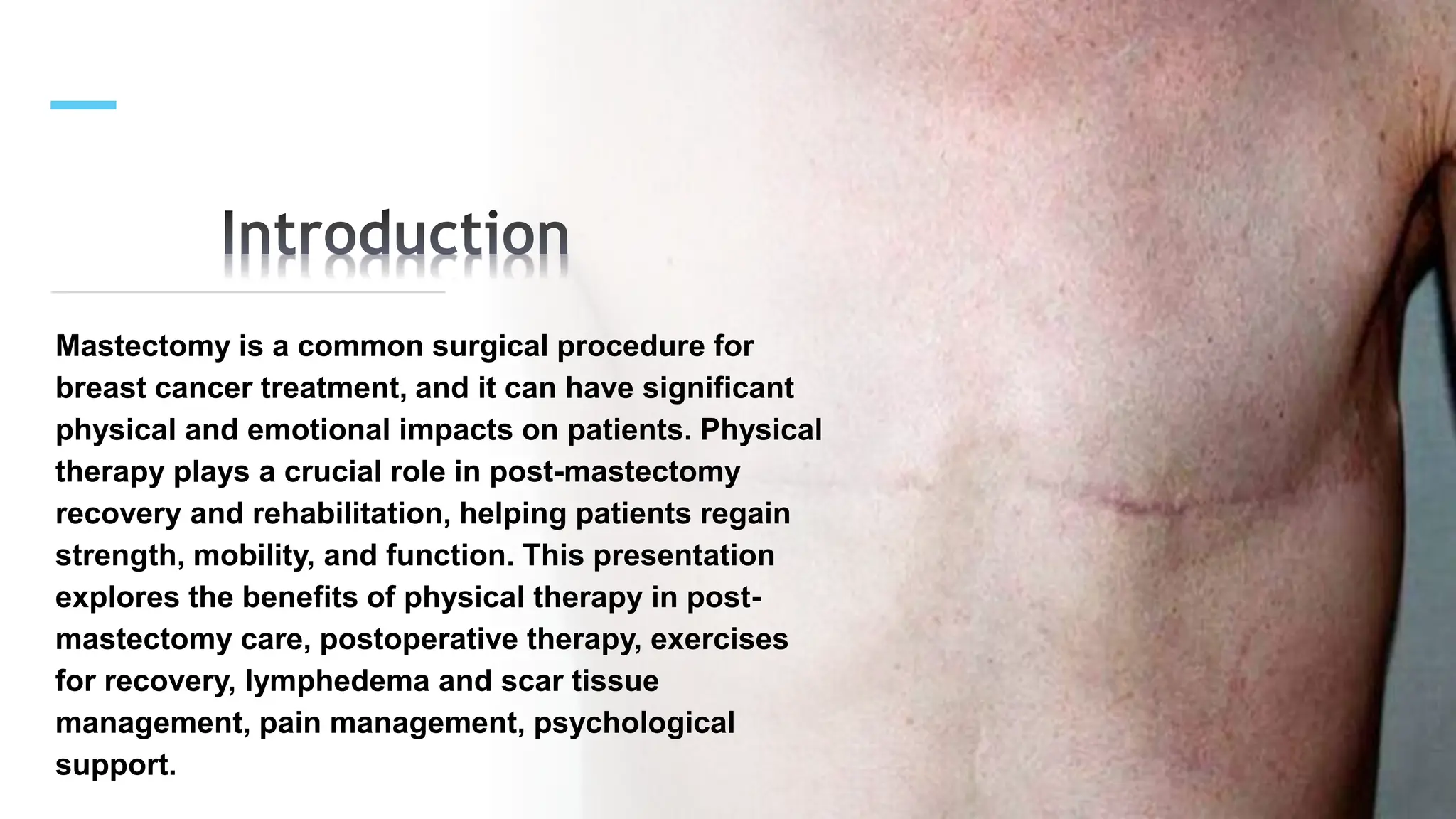 women health mastectomy assignment.pptx