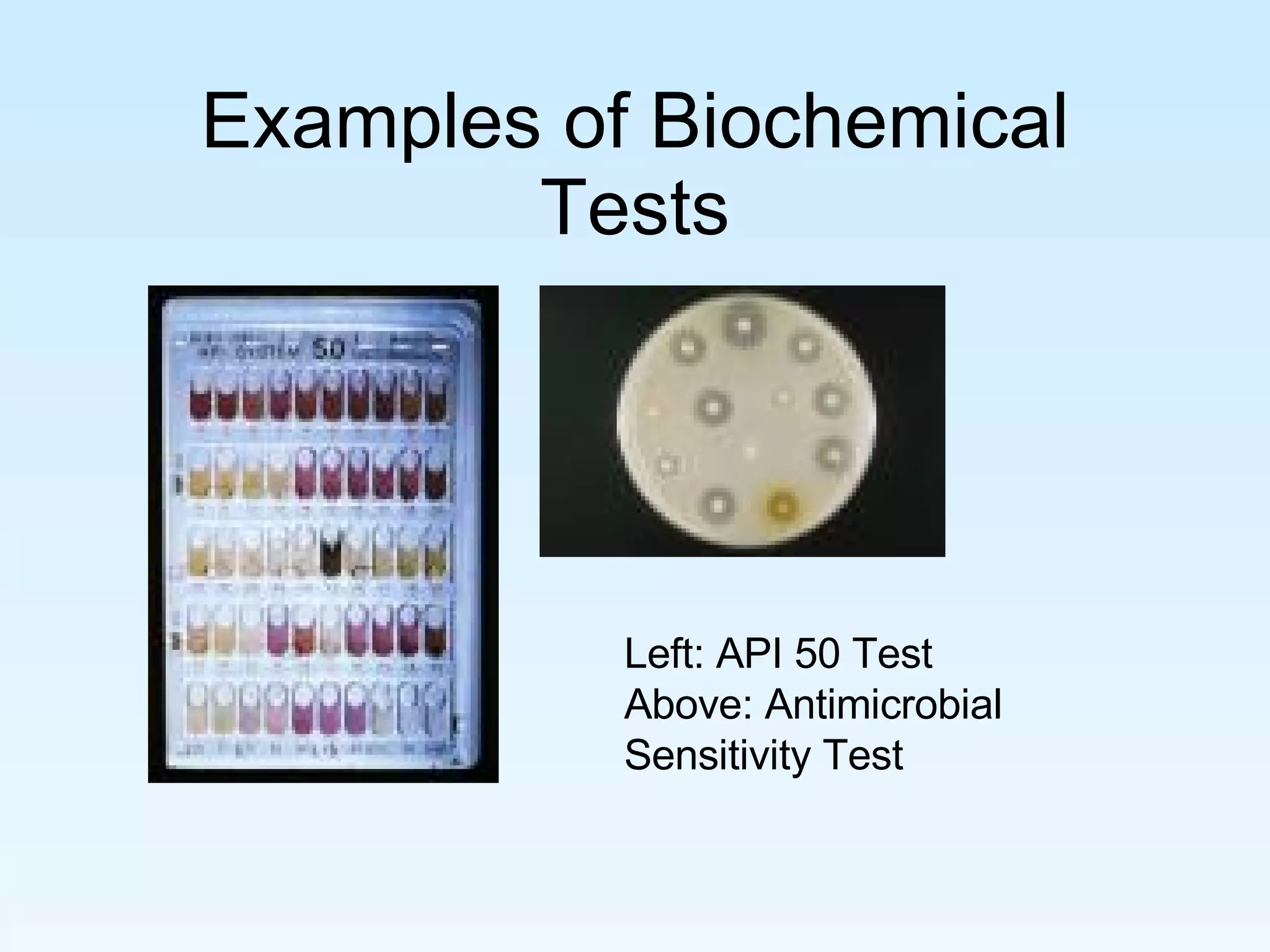 microbiological diagnosis | PPT