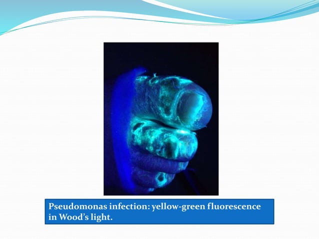 Wood’s light in dermatology