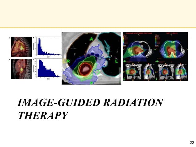 Image processing in lung cancer screening and treatment | PPTX