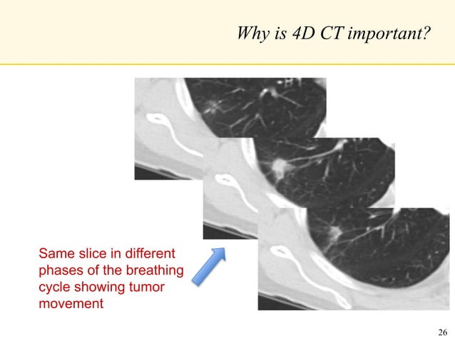 Image processing in lung cancer screening and treatment | PPTX