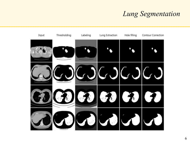 Image processing in lung cancer screening and treatment | PPTX