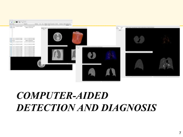 Image processing in lung cancer screening and treatment | PPTX