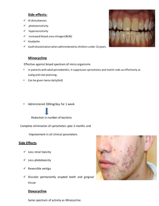 Word anti infective therapy | DOCX