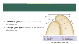Working-L, Endo-M , Apex-L.pptx طول کار کرد | PPT