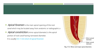 Working-L, Endo-M , Apex-L.pptx طول کار کرد | PPT