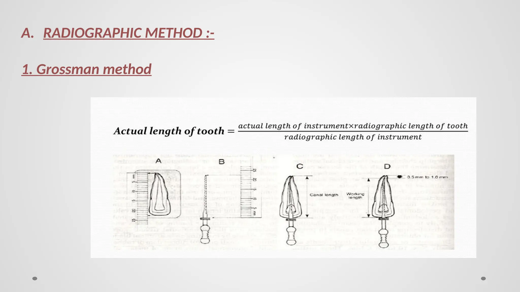 working length by different method dental | PPTX