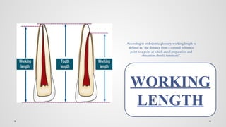 working length by different method dental | PPT