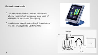 working length by different method dental | PPT