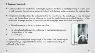 working length by different method dental | PPT