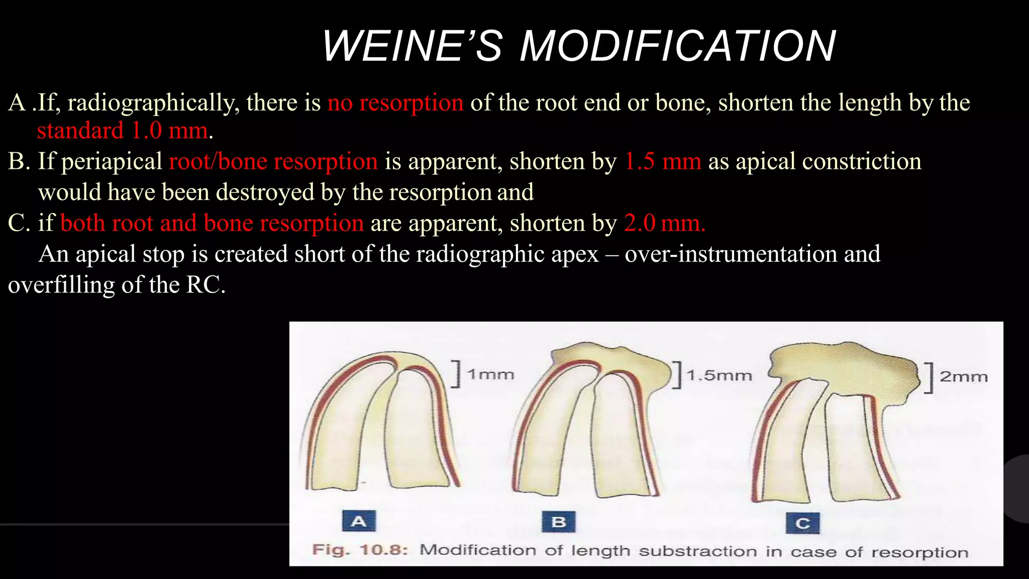 Working length Determination | PPTX