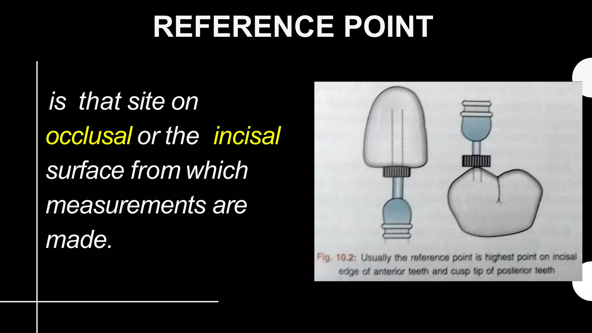 Working length Determination | PPTX