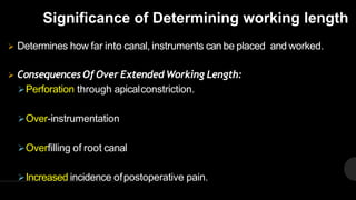 Working length Determination | PPTX