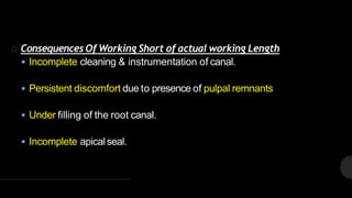 Working length Determination | PPTX