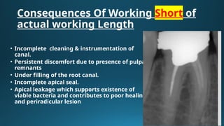 working length degfggsegegfafafasfda.pptx