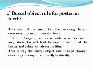 Working length determination | PPTX