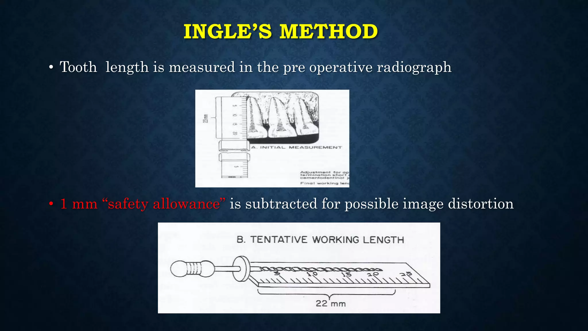 Working length determination IN ENDODONTICS | PPTX