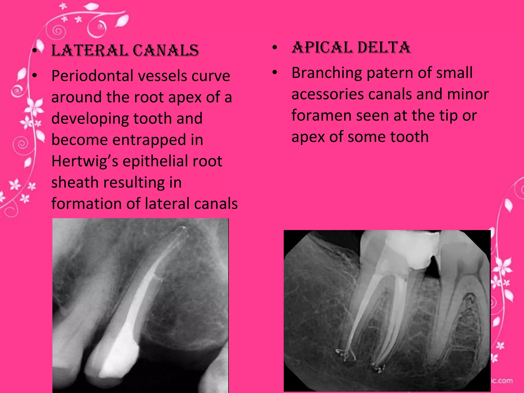 Working length determination | PPT