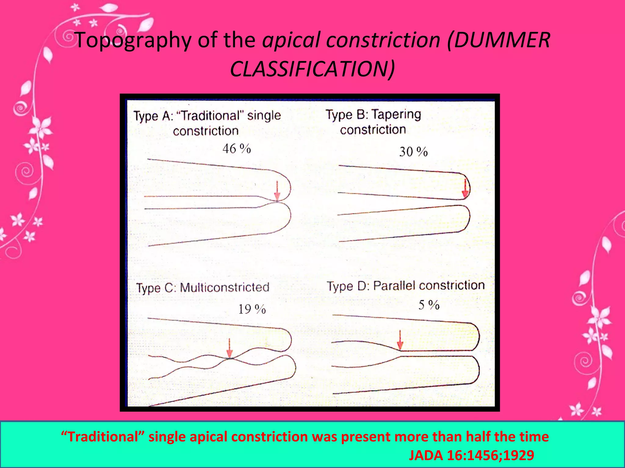 Working length determination | PPT